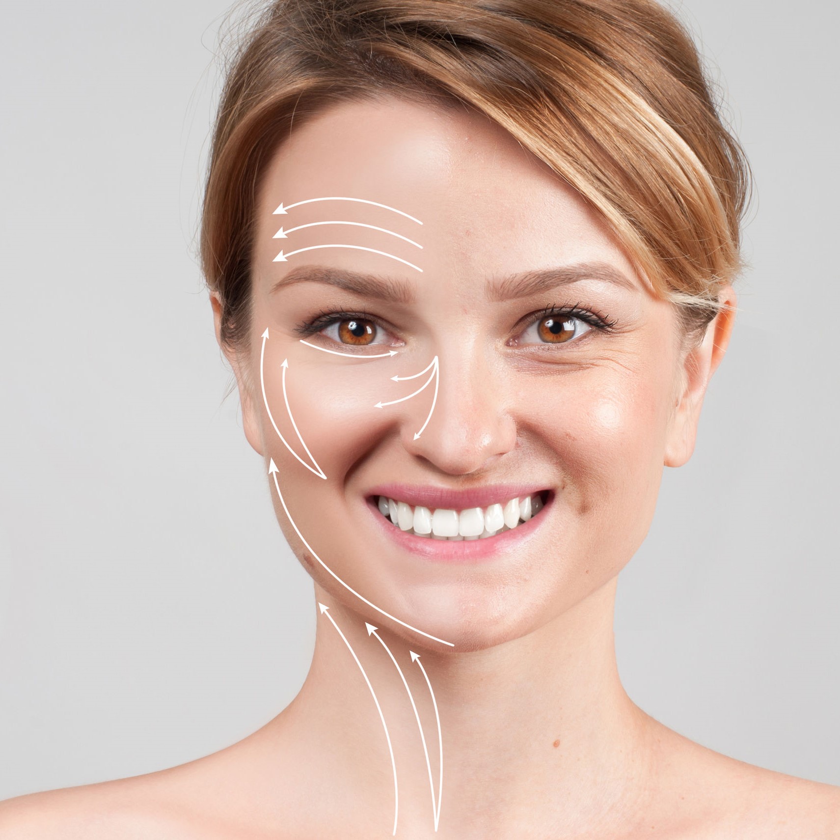 Relachement cutané - Centre Laser Médical de l'Etoile